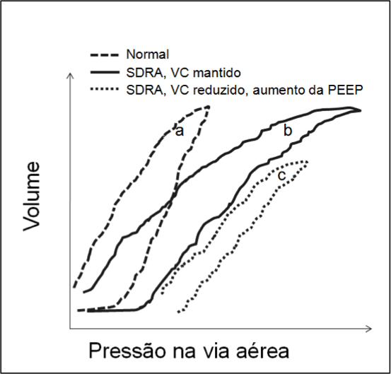 Manual de Ventilação Mecânica - Monitorização da Mecânica Respiratória ...
