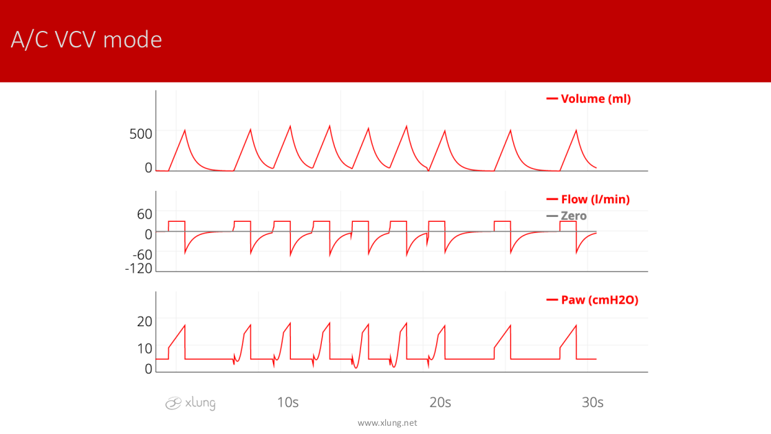 Basic Modes of Mechanical Ventilation - xlung.net